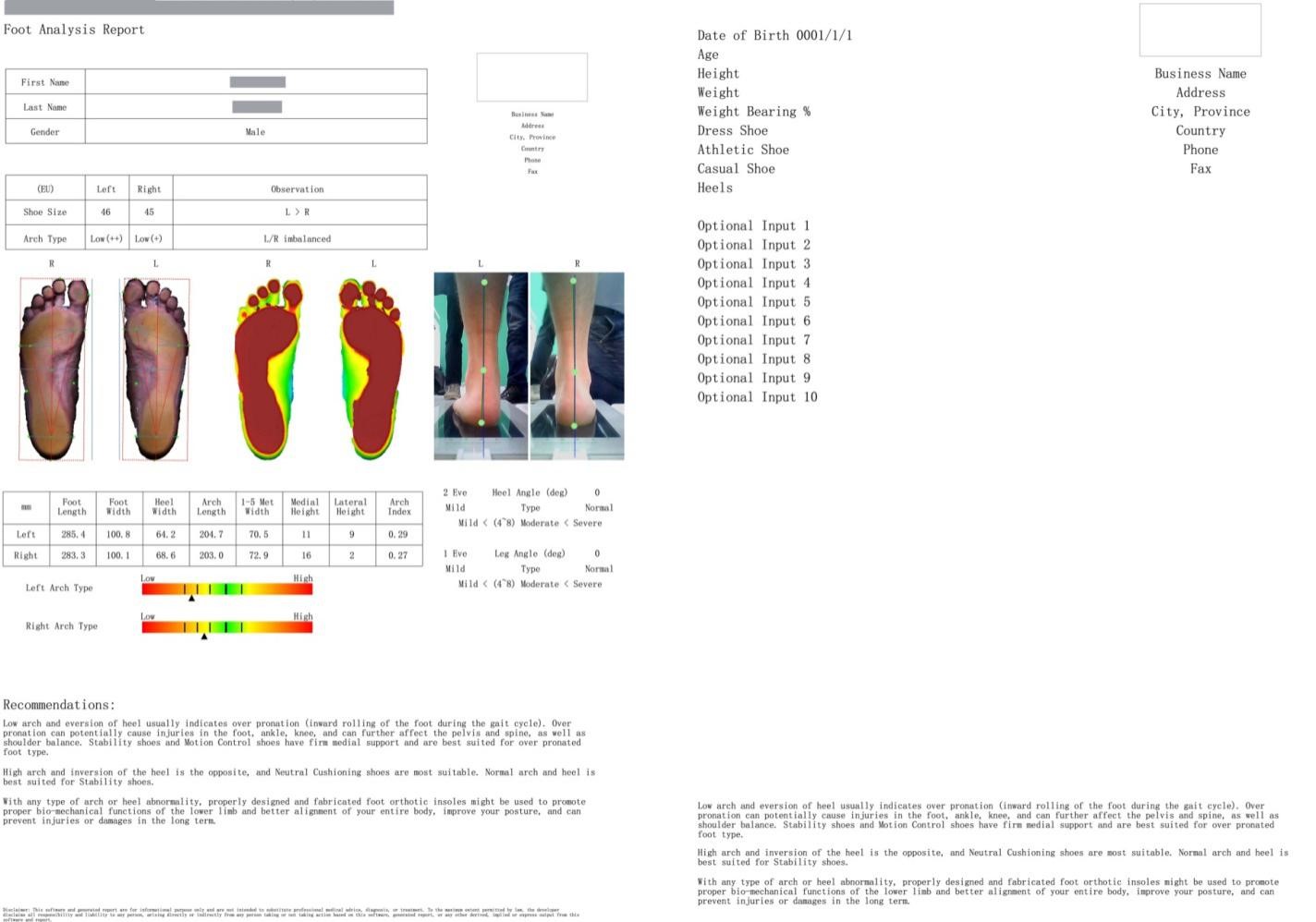 Stages of 3D-Production of Orthopedic Insoles